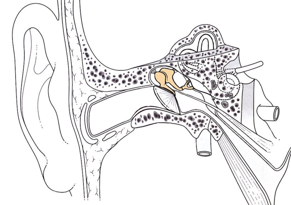 Understanding Otosclerosis