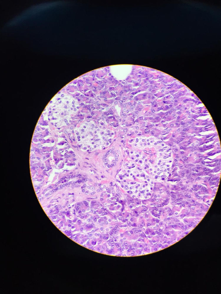 Páncreas 400x | Elysium