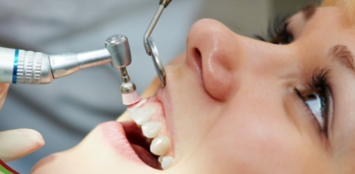 CALCULO DENTAL... ¿QUE ES?