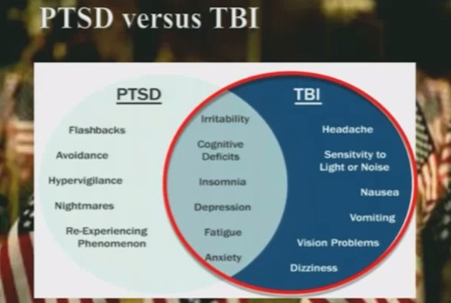The Concurrence of Traumatic Brain Injury and Post-traumatic Stress ...