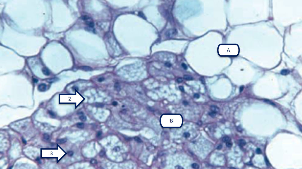 Tejido adiposo 400x H&E | Elysium