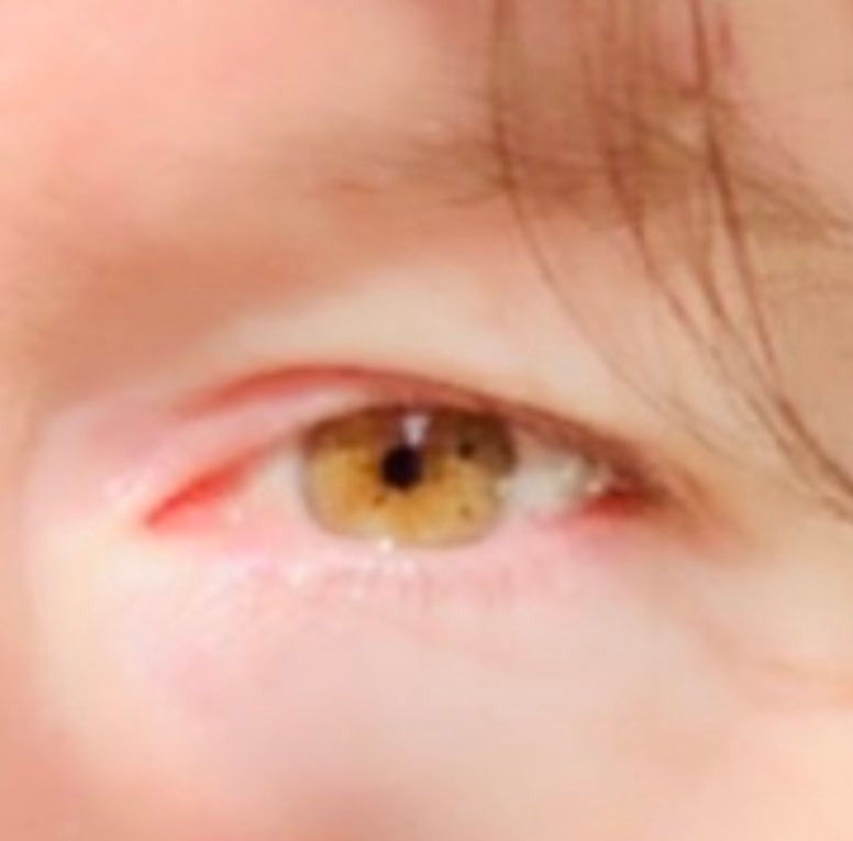 Amber Eyes: The Most Underrepresented Eye Color