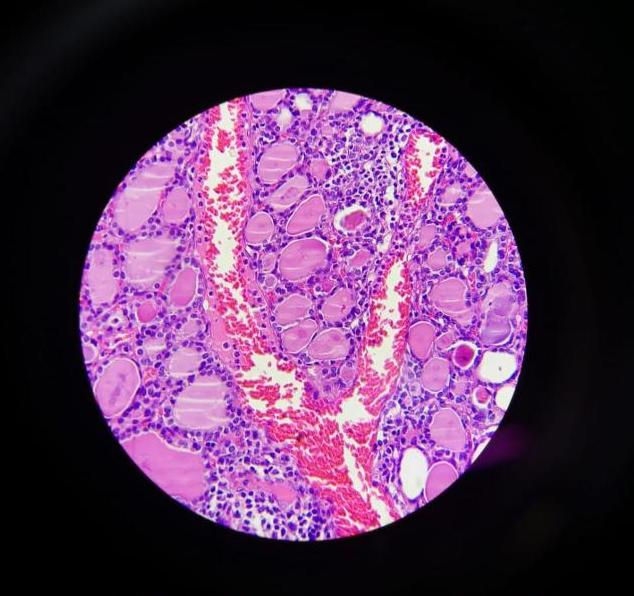 Glándula tiroides 400x | Elysium