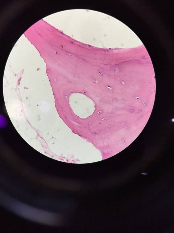 HUESO (osteona) | Elysium