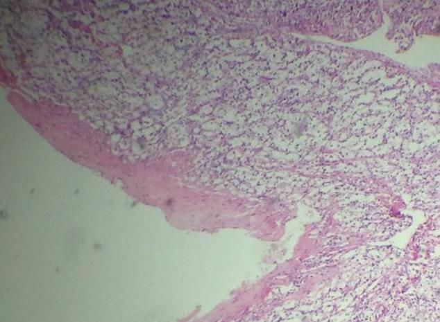 Glándula suprarrenal 40x | Elysium