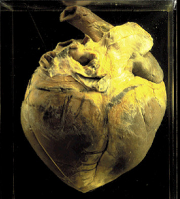 The Equine Heart (Part 1): What Makes the Horse Such an Amazing Athlete?