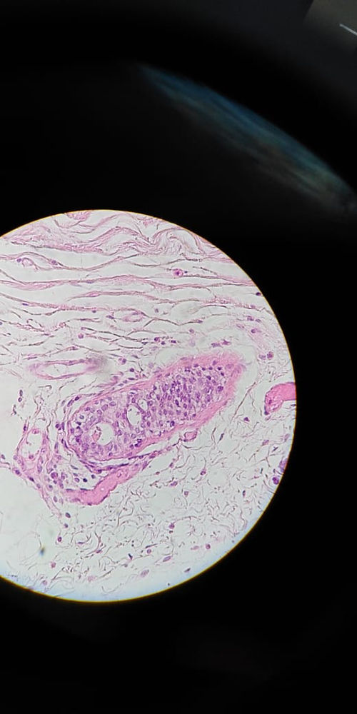 Glándula mamaria 40x | Elysium