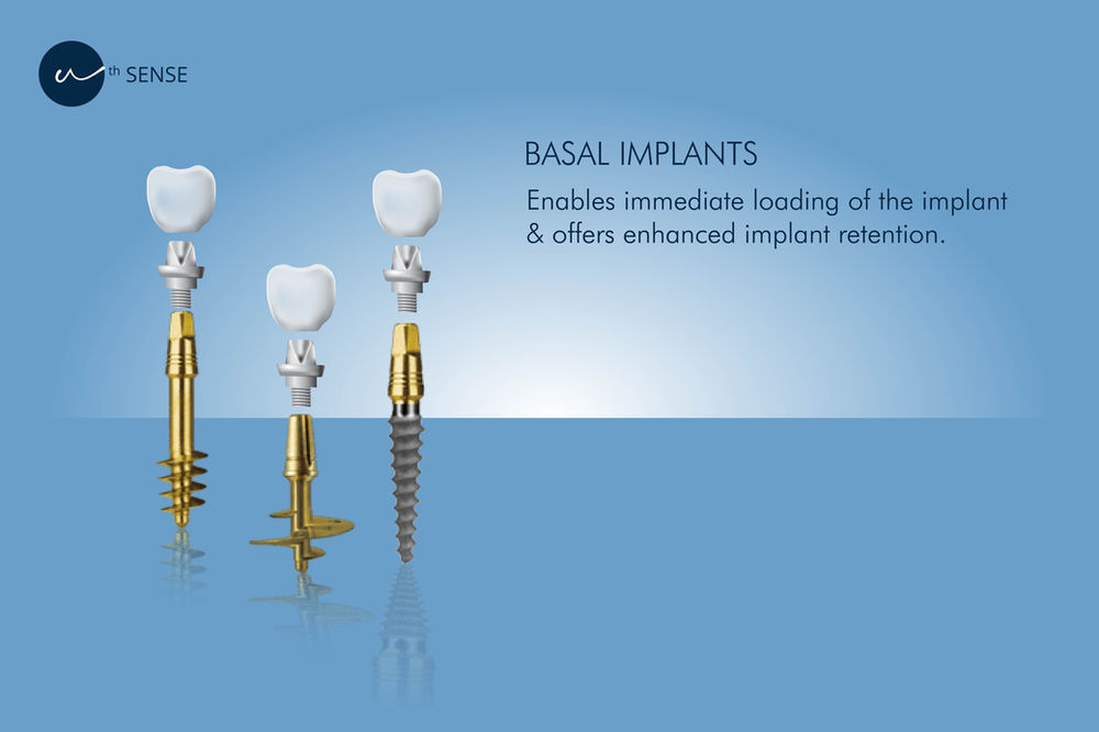 All about Dental Implants |Dr. Purav Mehta | Dental Care