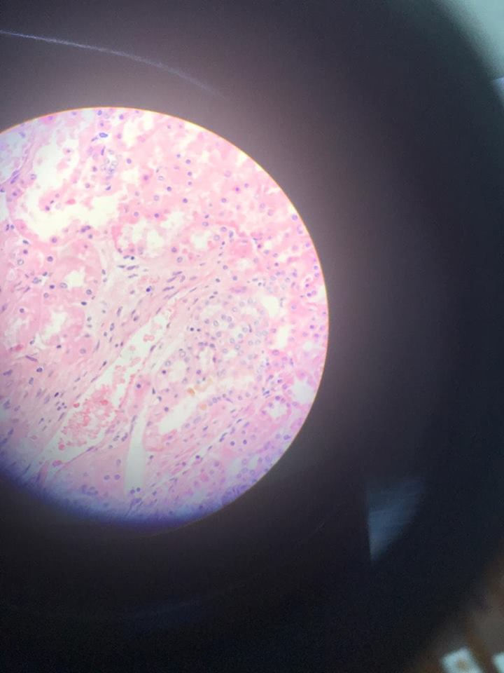 Laminilla: Riñón, Aumento: 400x, Tincion: Hematoxilina eosina | Elysium