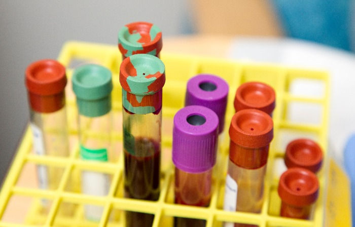 What's in a Blood Test?