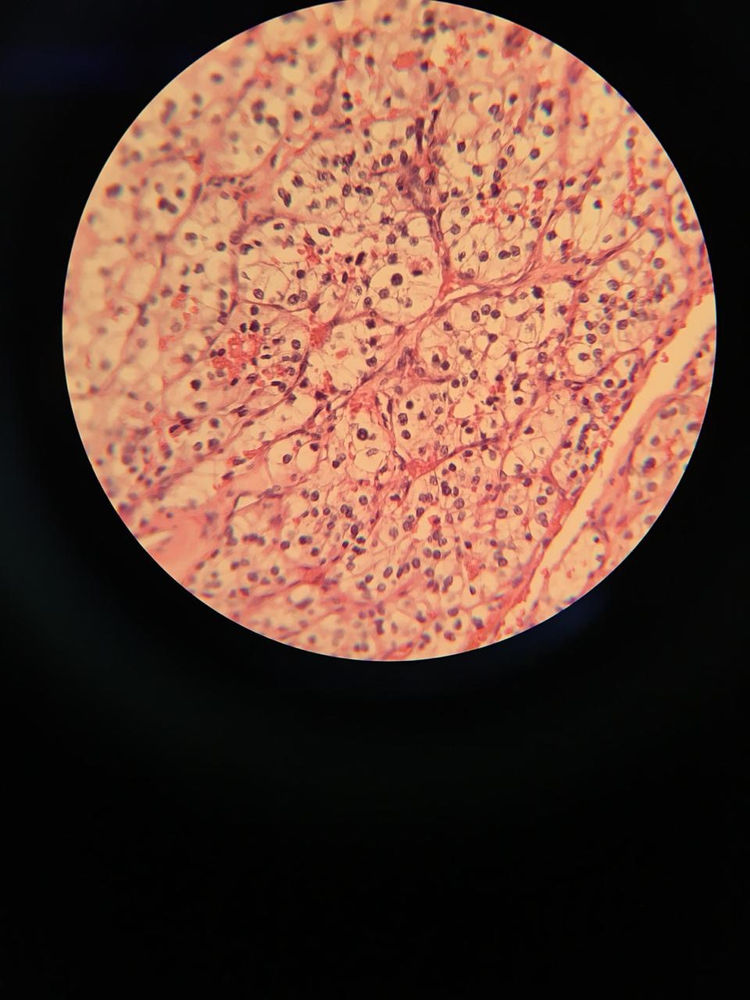 Glándula suprarrenal 400x | Elysium