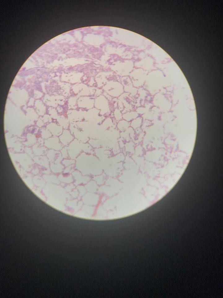 Laminilla: Pulmon, Aumenoto 400x Tincion: Hematoxilina eosina | Elysium