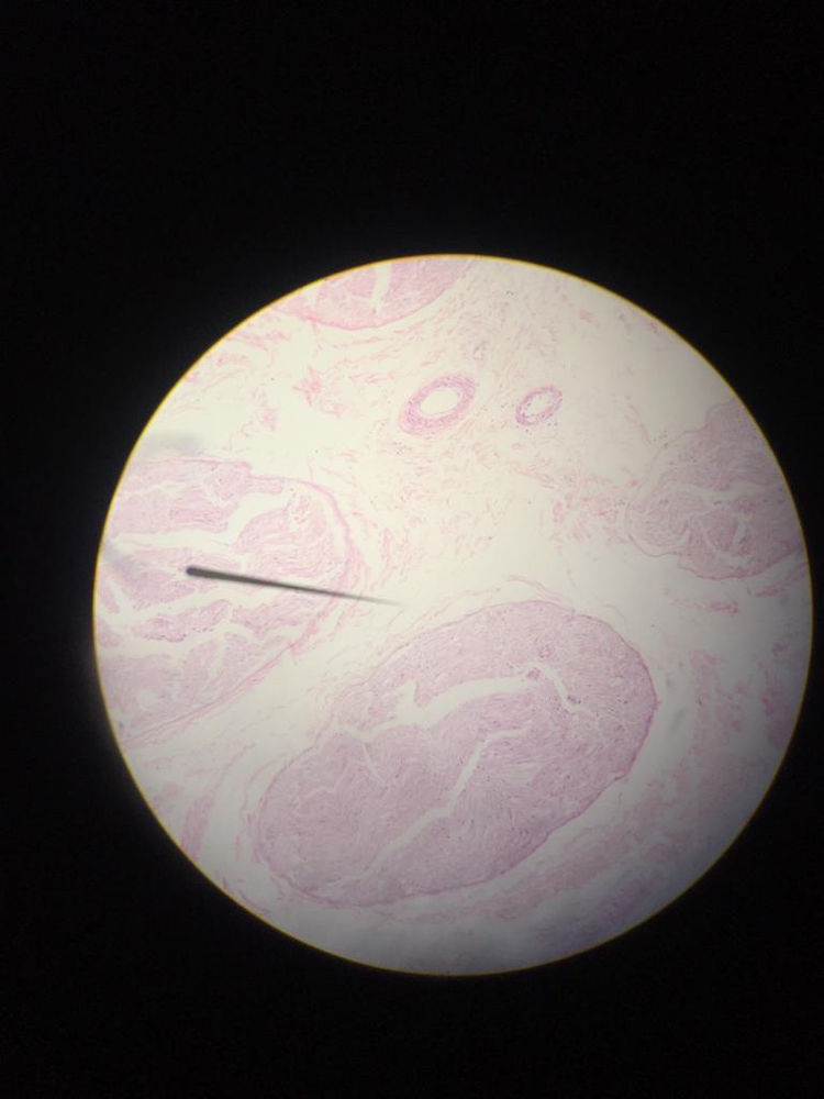 Nervio 400x | Elysium