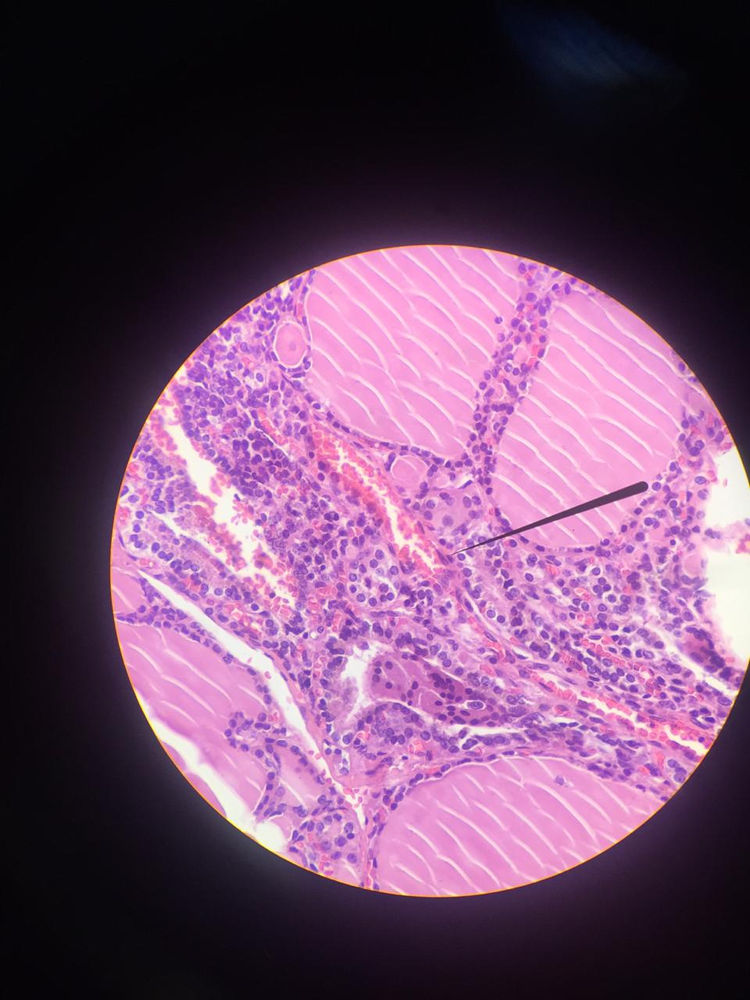 Tiroides, 40x | Elysium