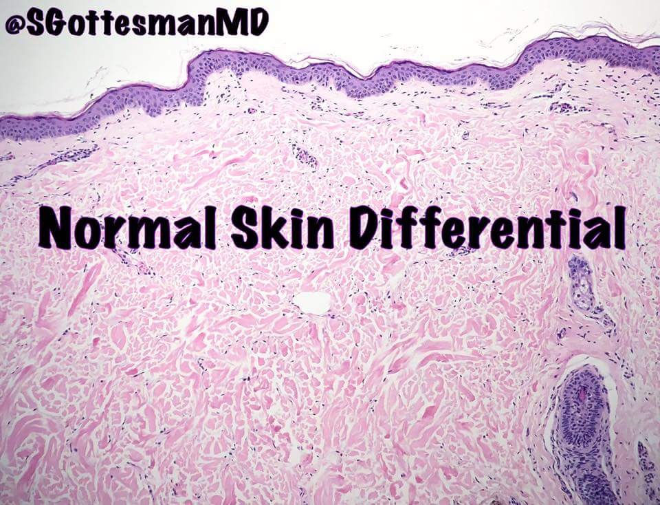 Normal skin histology differential diagnoses | Archive of McKeeDerm