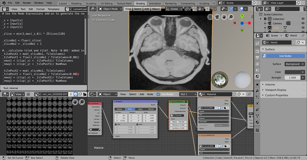 MRI Work in Progress