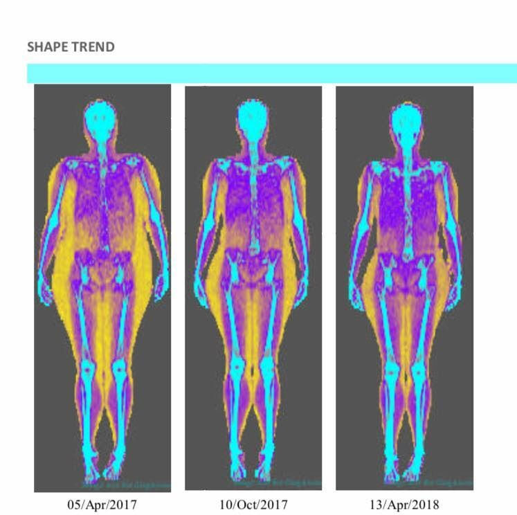 Considering Body Composition