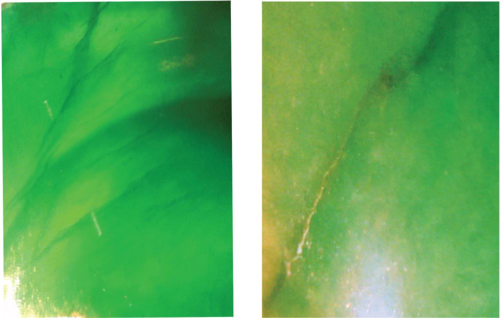 The Truth about Imperial Jadeite