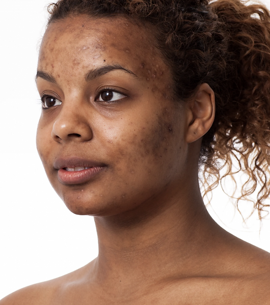 La Boutique- Soins des peaux noires et métissées