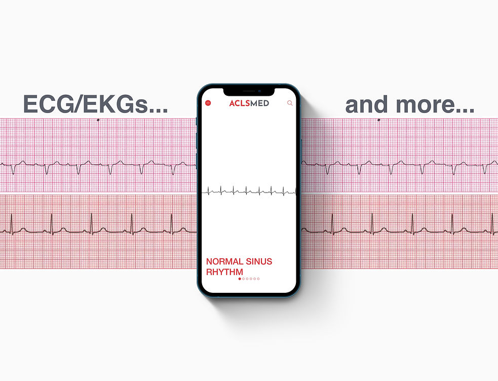 ACLSMED - ECG/EKG learning essentials. ACLS Algorithms. ECG Rhythms ...