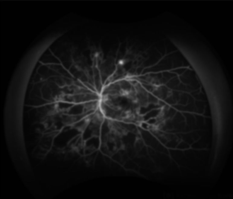 1. Ocular Anesthesia | Eyesite Academy