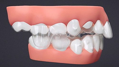 Invisalign Comprehesive | Ortodoncia CDMX