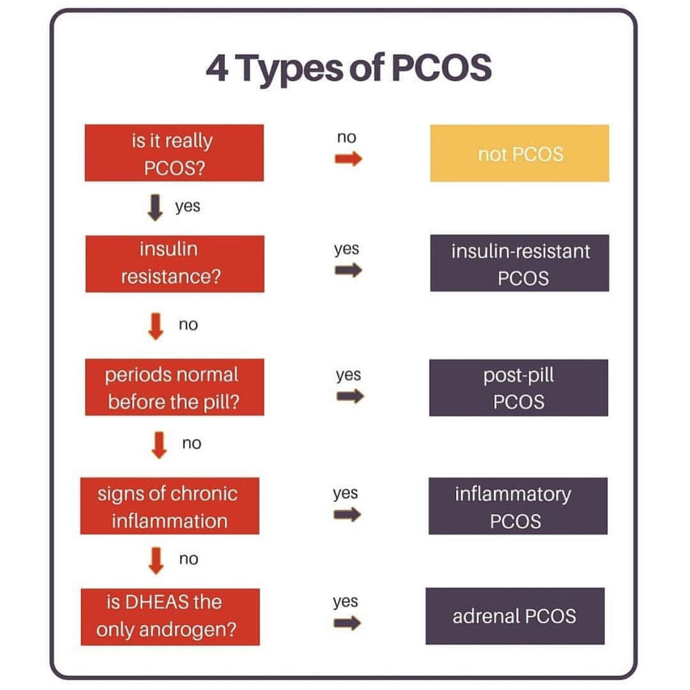 The Four Types of PCOS