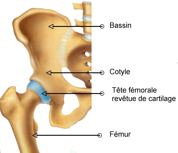 Douleurs de Hanche