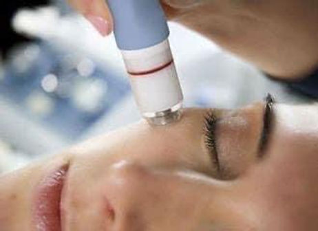 Refresh your beautiful face with Bio-Brasion!