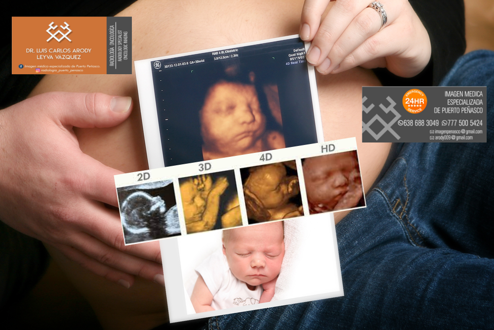 3d Ultrasound Obstetrics