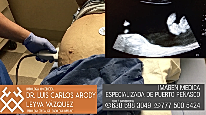 ULTRASOUND-guided paracentesis