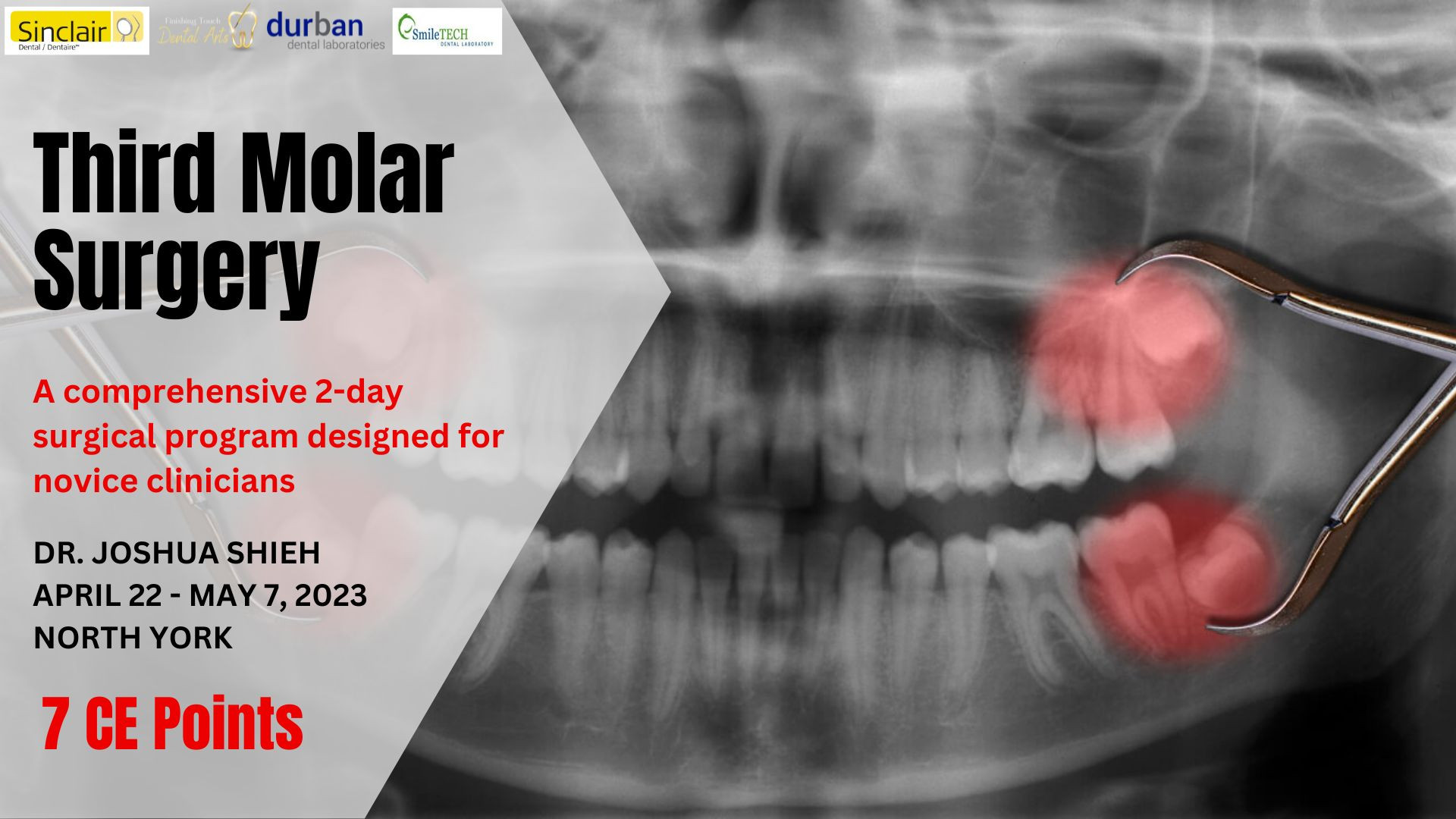Third Molar Surgery | Durban Dental Lab