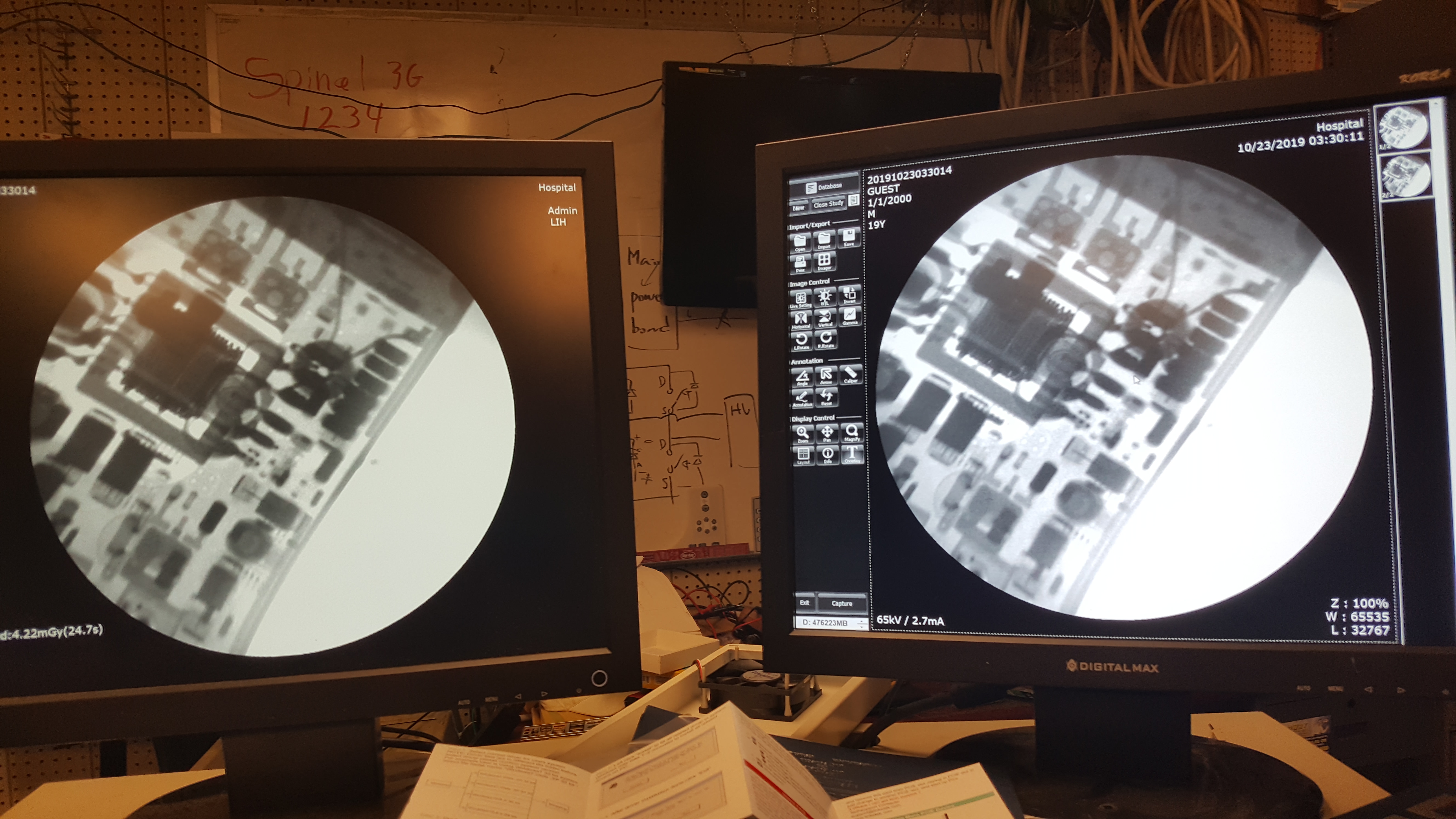 Fluoroscope | United States | Radiological Imaging Systems