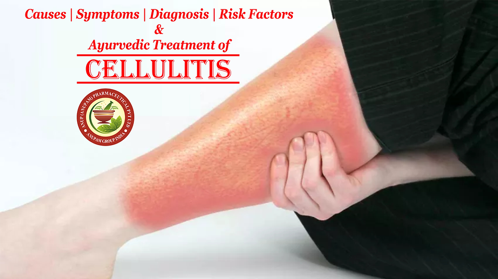 What is Cellulitis | Causes | Symptoms | Diagnosis Methodology | Risk ...