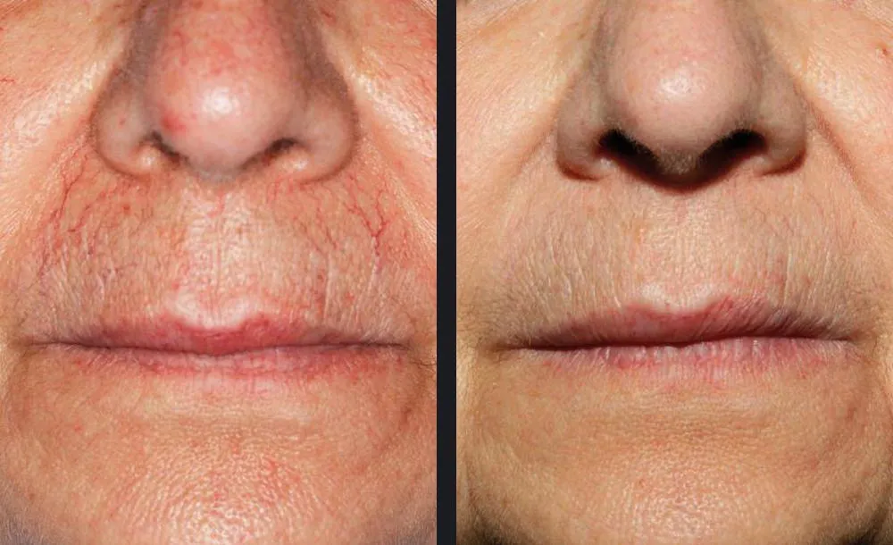 Understanding the Significance of Vascular Lesions