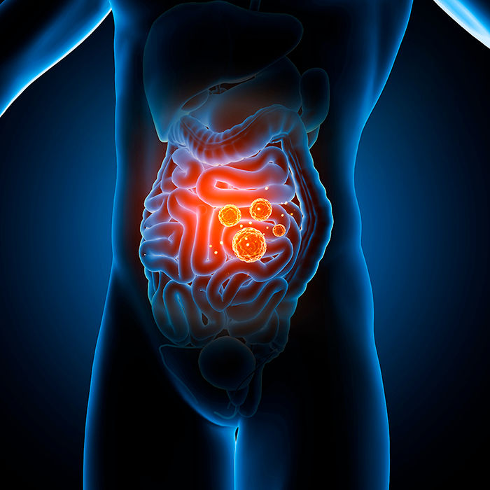 Disbiose intestinal. O que é e como tratar?