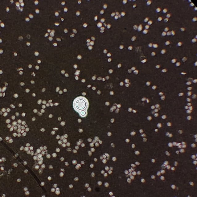 Cryptococcus sp. 🧫🔬🤓