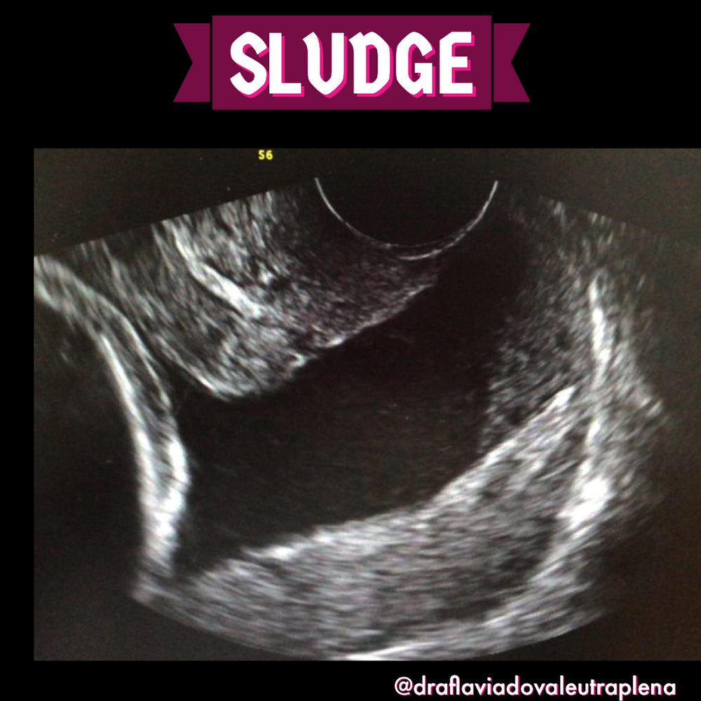 SLUDGE - O que é sludge e o que significa