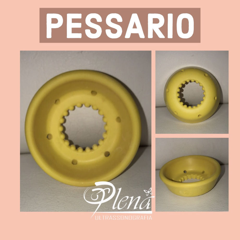 Incompetência Istimo Cervical