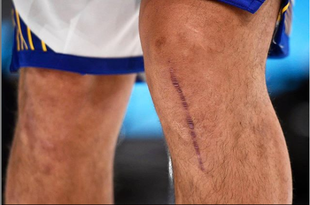 Home | Optimal Movement Rehabilitation