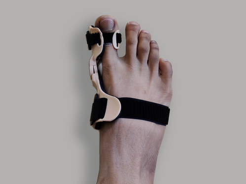 Bunion Splint | Cre-AID LABS