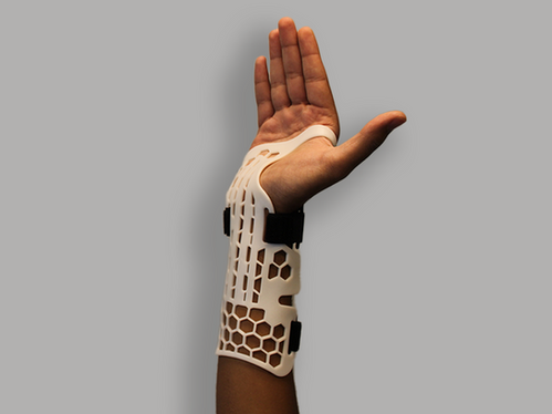 Cockup Splint | Cre-AID LABS