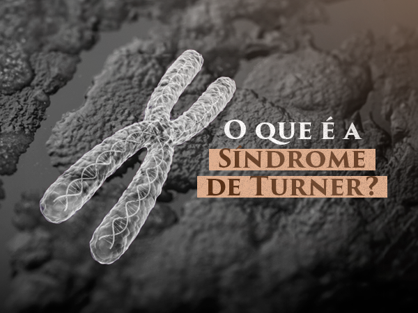 O que é a Síndrome de Turner?