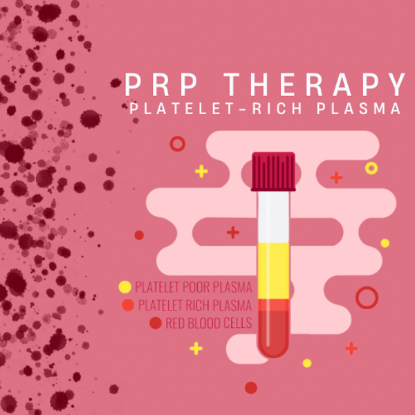 Platelet-Rich Plasma (PRP) Therapy