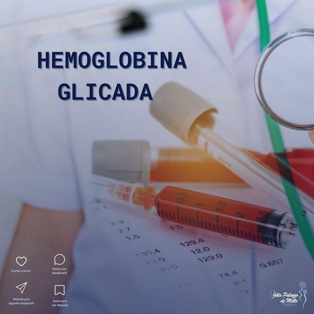 HEMOGLOBINA GLICADA