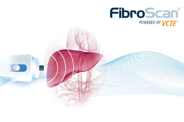 Liver Scan Direct | FibroScan | Canada