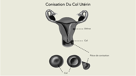 Opérations | Docteur Olivier Marpeau | Chirurgien Gynécologue