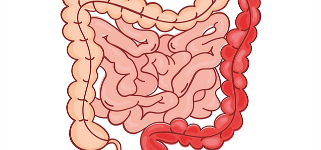 ulcerative colitis causes