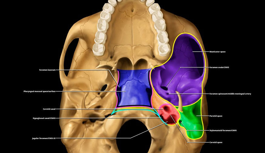Skull Base Osteomyelitis: An emerging clinical entity.