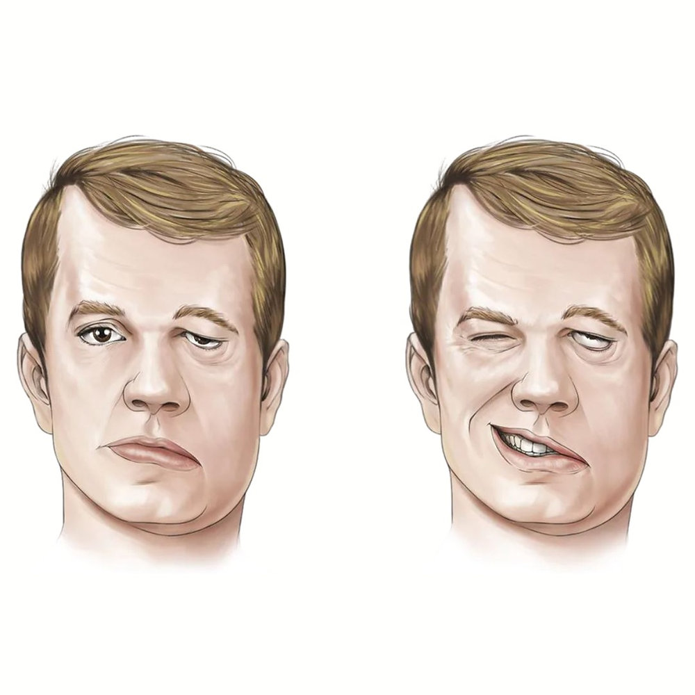 A Comprehensive Guide to Facial Rehabilitation Protocol